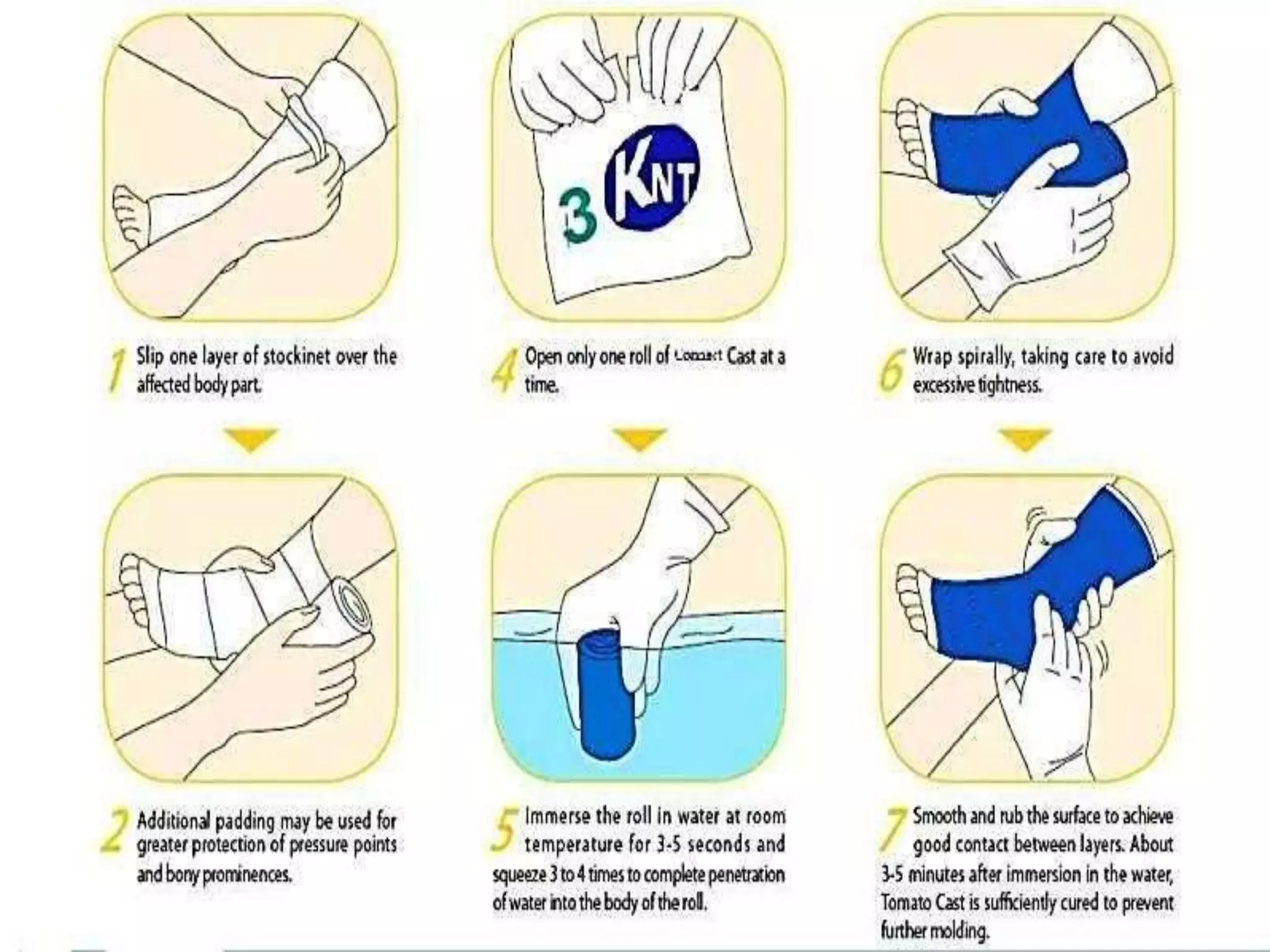 care of patient with cast.pptx