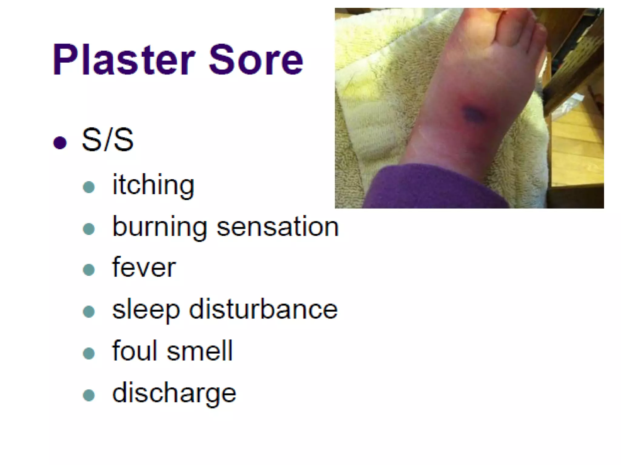 care of patient with cast.pptx