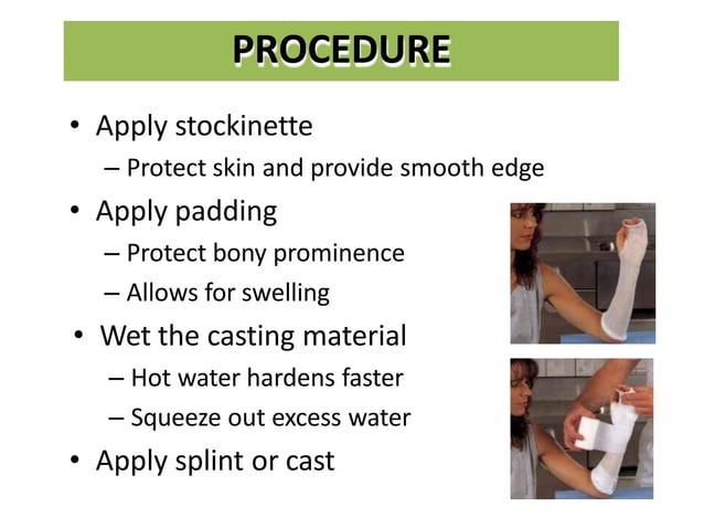 care of patient with cast.pptx