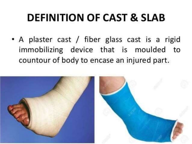 care of patient with cast.pptx