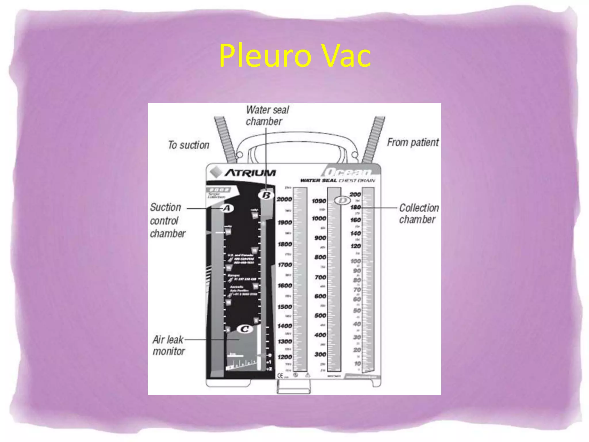 Care of patient with chest drainage system | PPTX