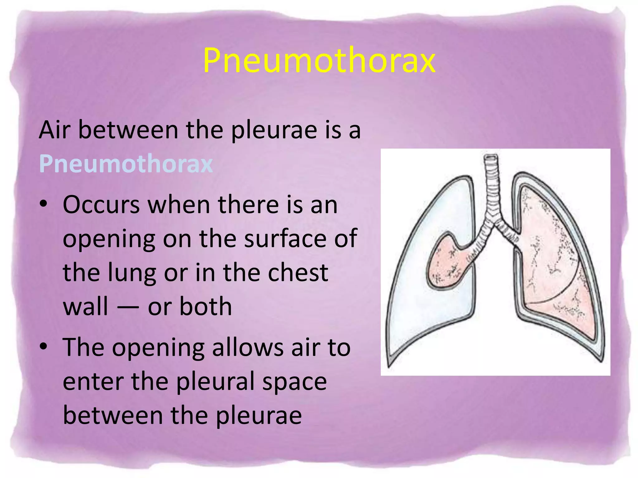 Care of patient with chest drainage system | PPTX