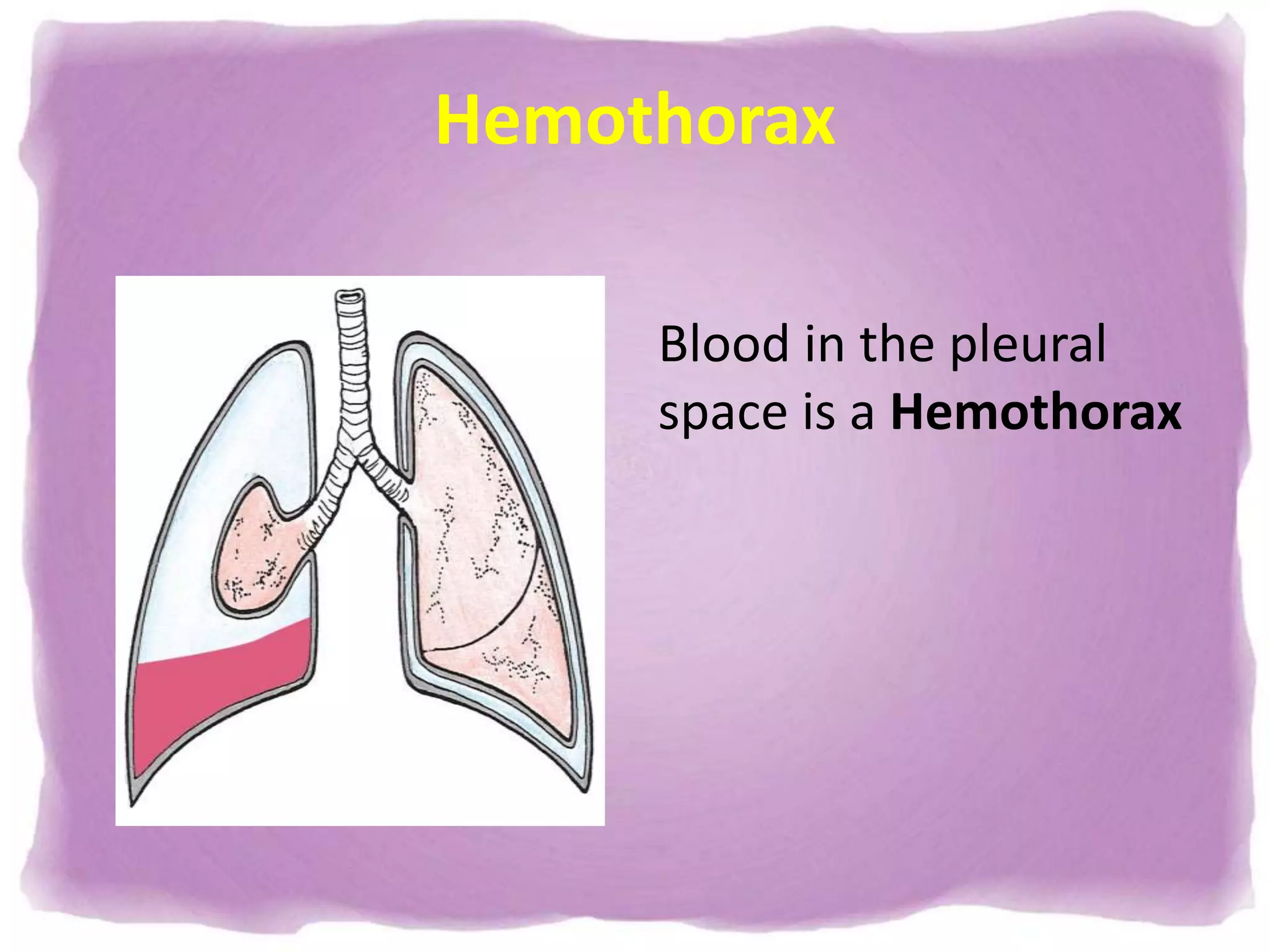 Care of patient with chest drainage system | PPTX