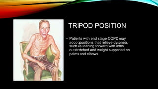 Tripod Position Copd