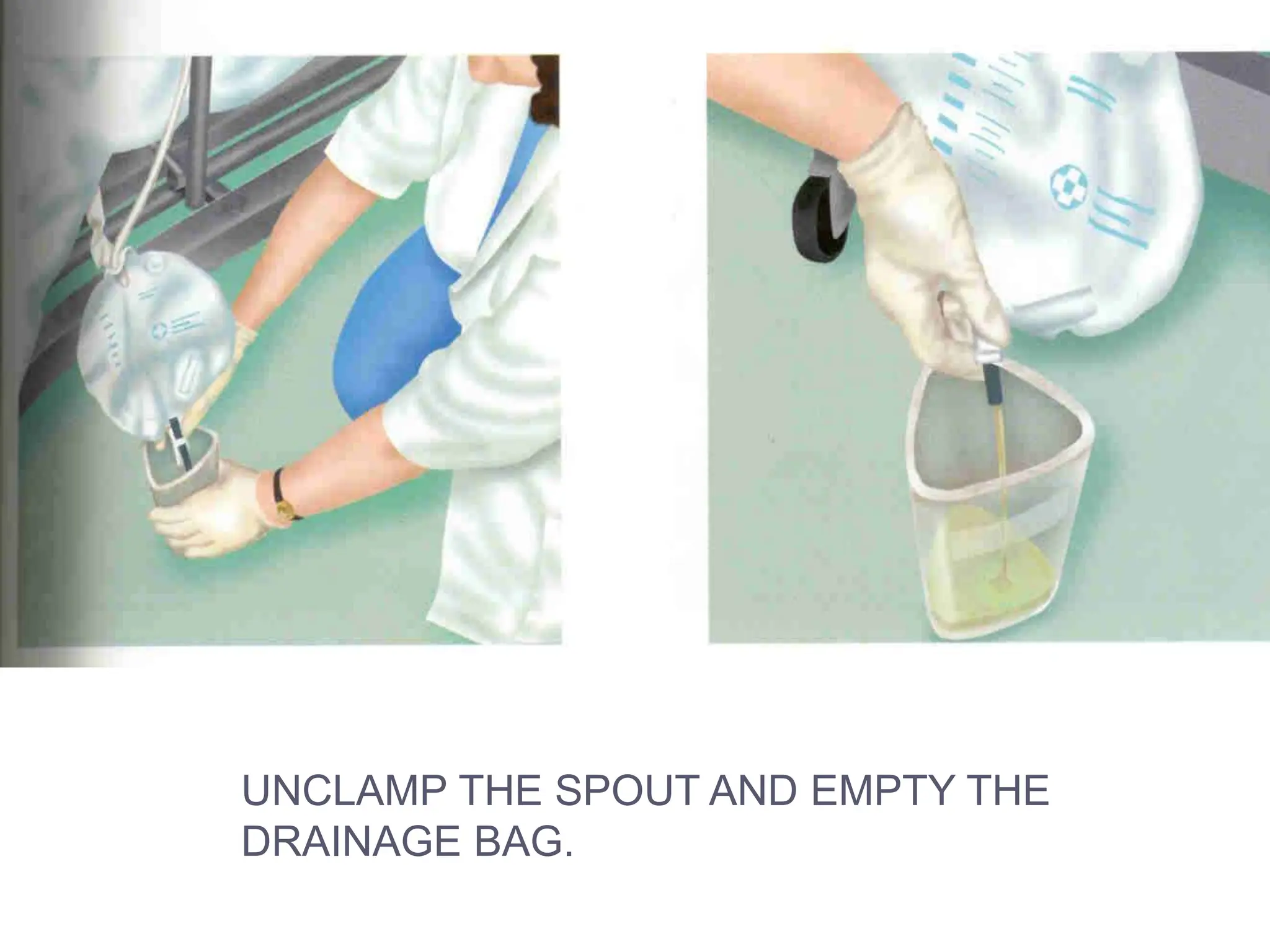 Care of Patient With Drains and its nursing management.pptx