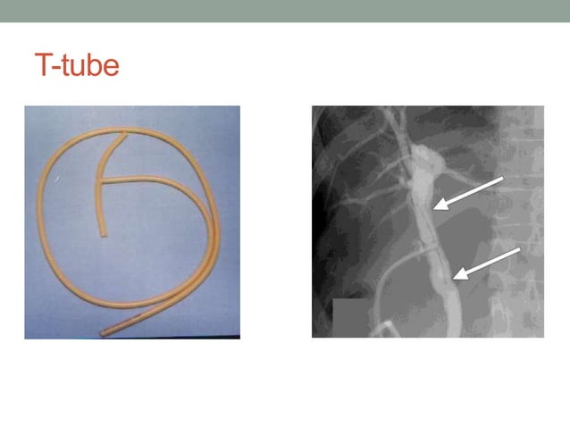 Care of Patient With Drains and its nursing management.pptx