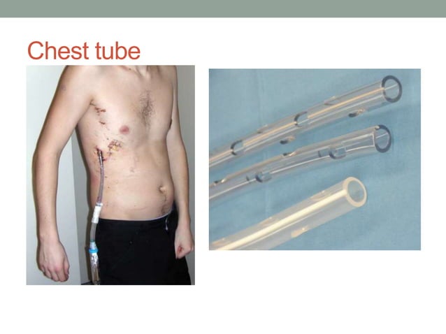 Care of Patient With Drains and its nursing management.pptx