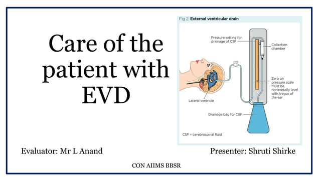 Care of patient with external ventricular drain | PPTX | Brain and Nervous System Disorders ...