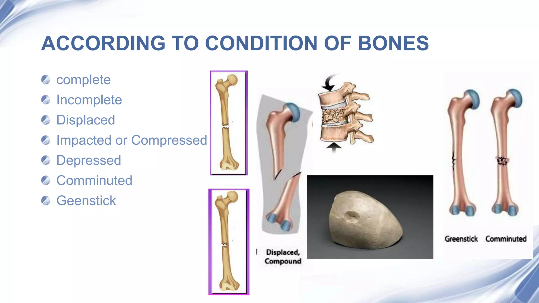 Care of patient with fracture (1) | PPTX