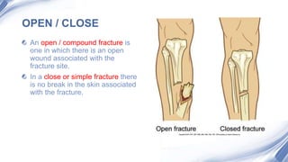 Care of patient with fracture (1) | PPTX