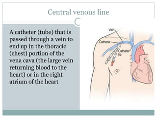 Nurse Hann On X: CENTRAL LINE VS PICC LINE X, 49% OFF