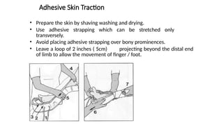 Care of patient with Traction.pptx for B | PPTX