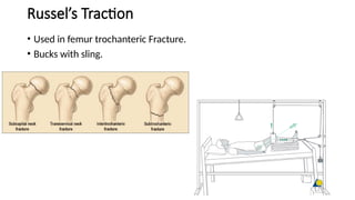 Care of patient with Traction.pptxforbsn | PPTX