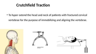 Care of patient with Traction.pptxforbsn | PPTX