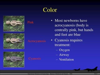 How to perform Care the Newborn.pptx
