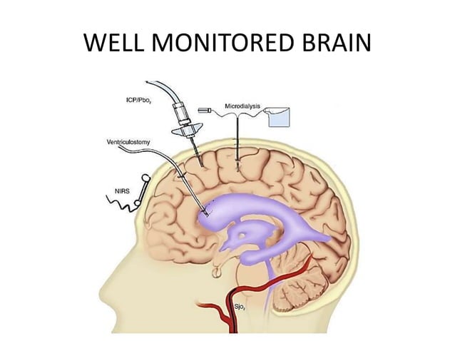 CARE OF THE PATIENT FOLLOWING CRANIOTOMY.pptx