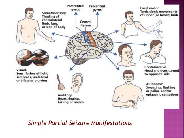 Care of the patient with convulsion | PPTX | Brain and Nervous System Disorders | Diseases and ...
