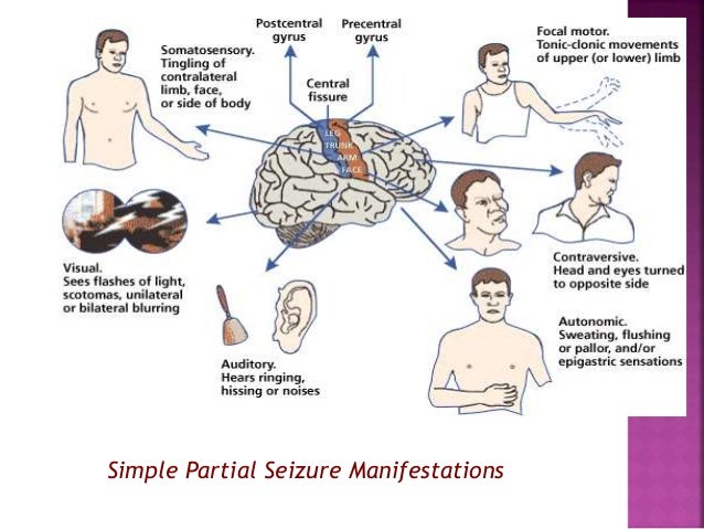 Care of the patient with convulsion
