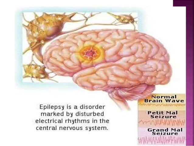 Care of the patient with convulsion