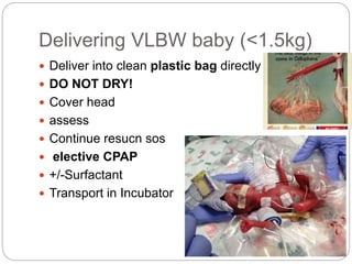 Care Of The Small Baby | PPTX