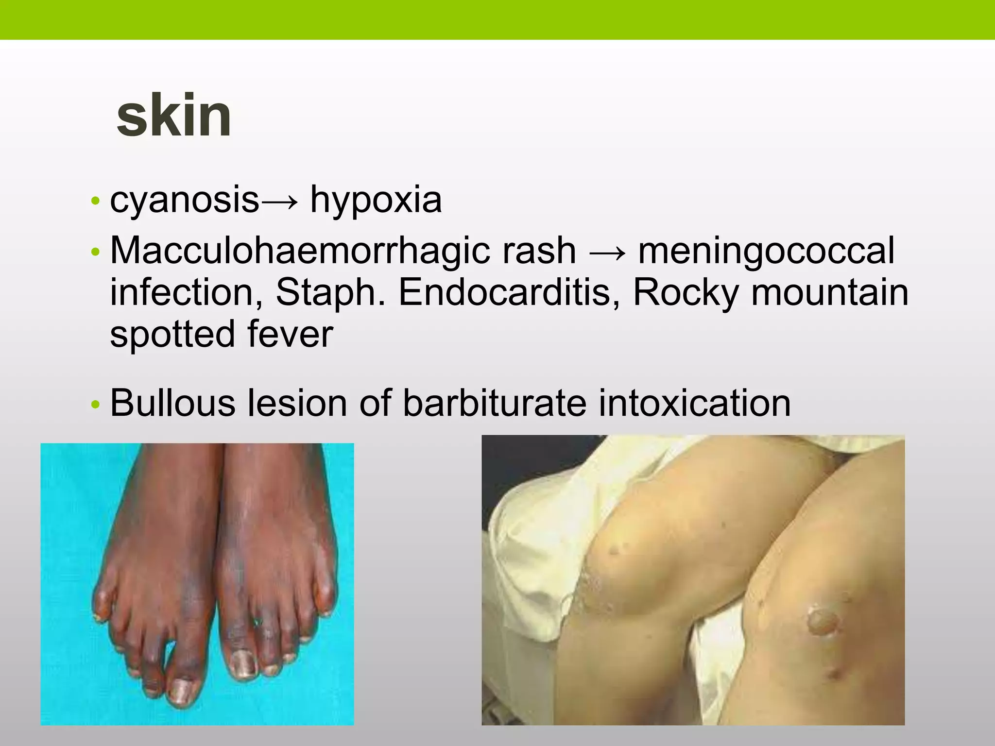 Care of unconscious patient | PPTX