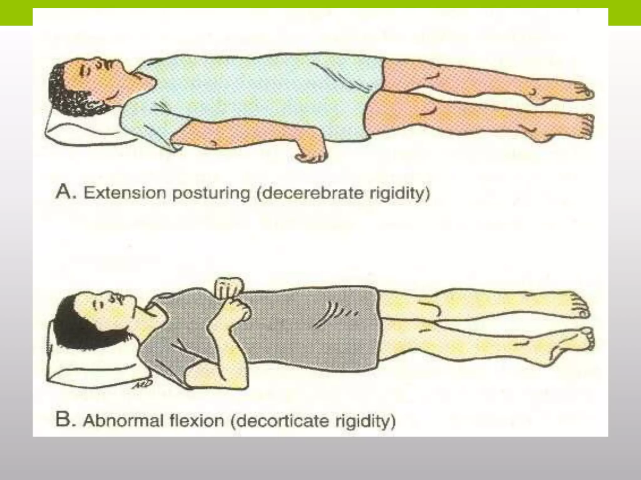 Care of unconscious patient | PPTX