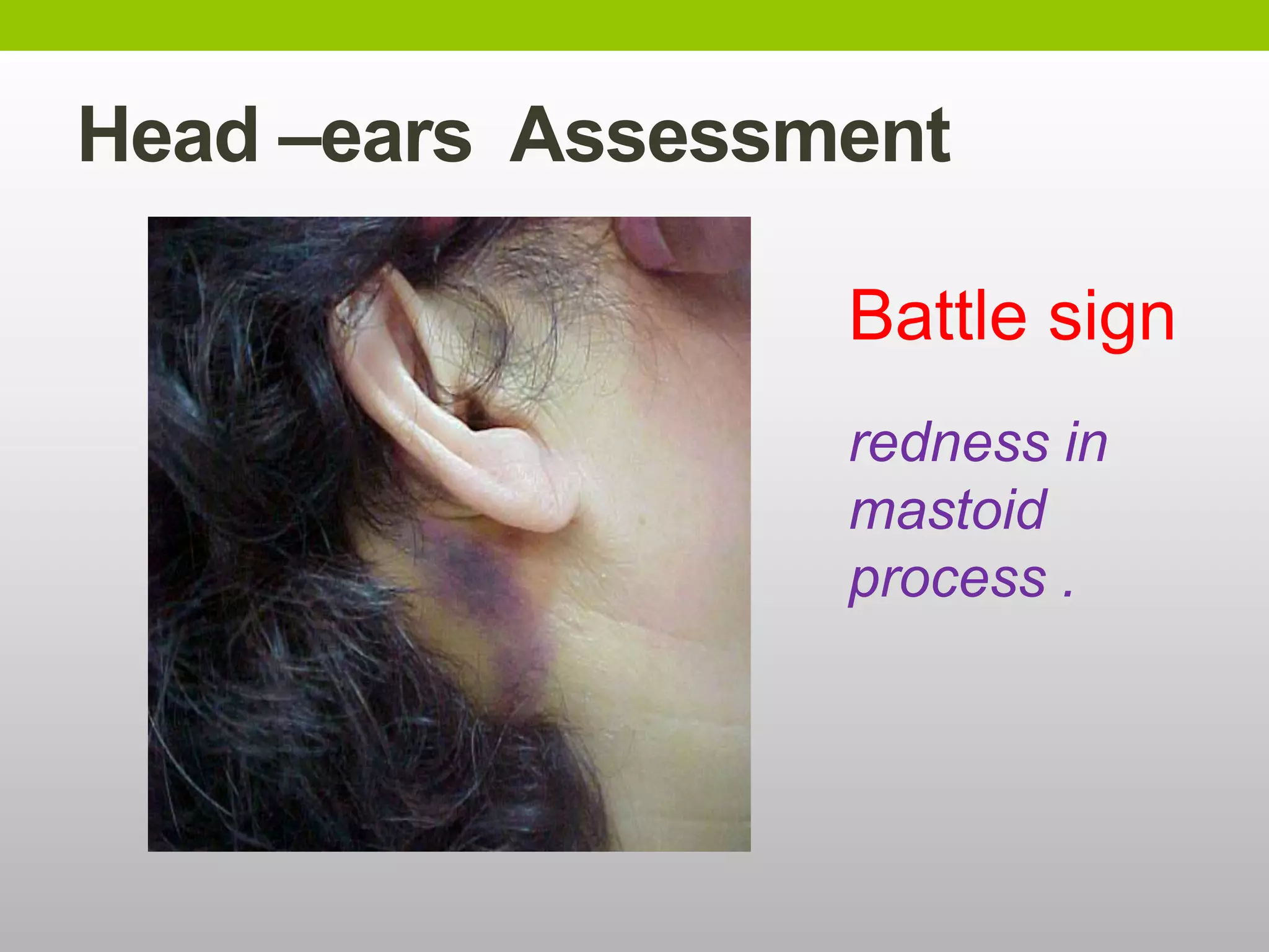 Care of unconscious patient | PPTX