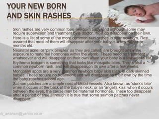 Care practices during infancy | PPSX