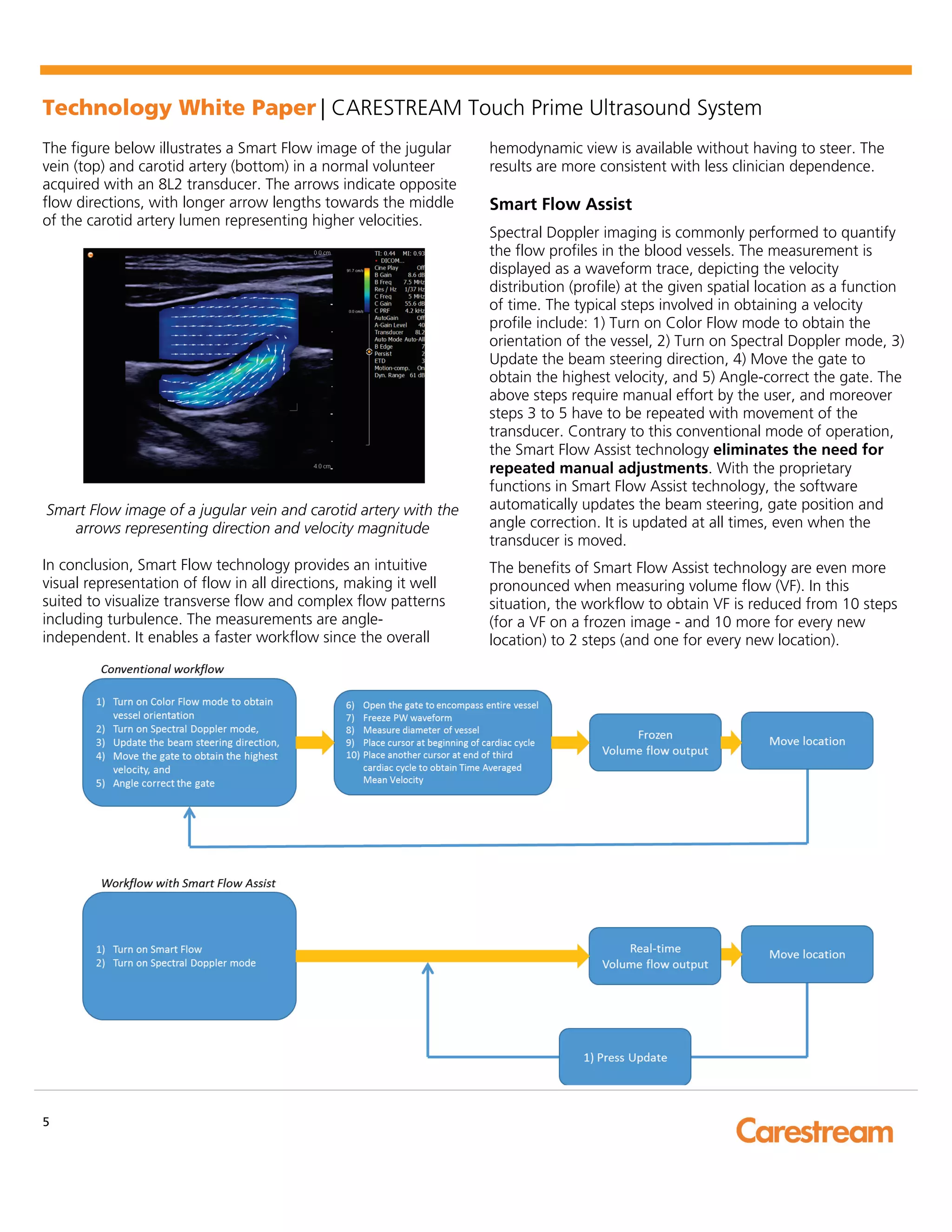 Carestream Whitepaper Advanced Ultrasound Imaging | PDF