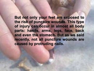 Care with nails | PPTX