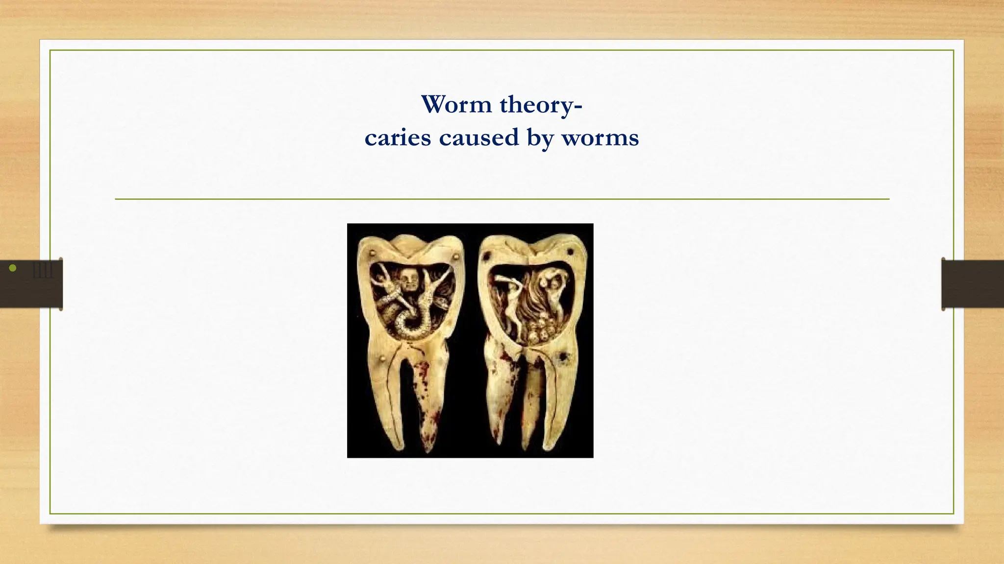 dental caries causes and its treatment .pptx