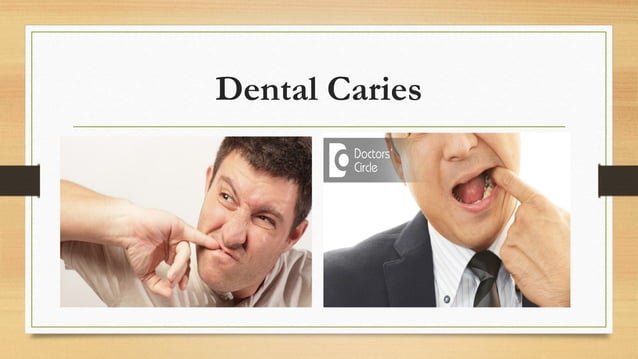 dental caries causes and its treatment .pptx