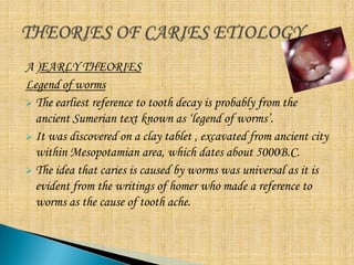 EPIDERMOLOGY AND PREVENTION OF DENTAL CARIES | PPTX