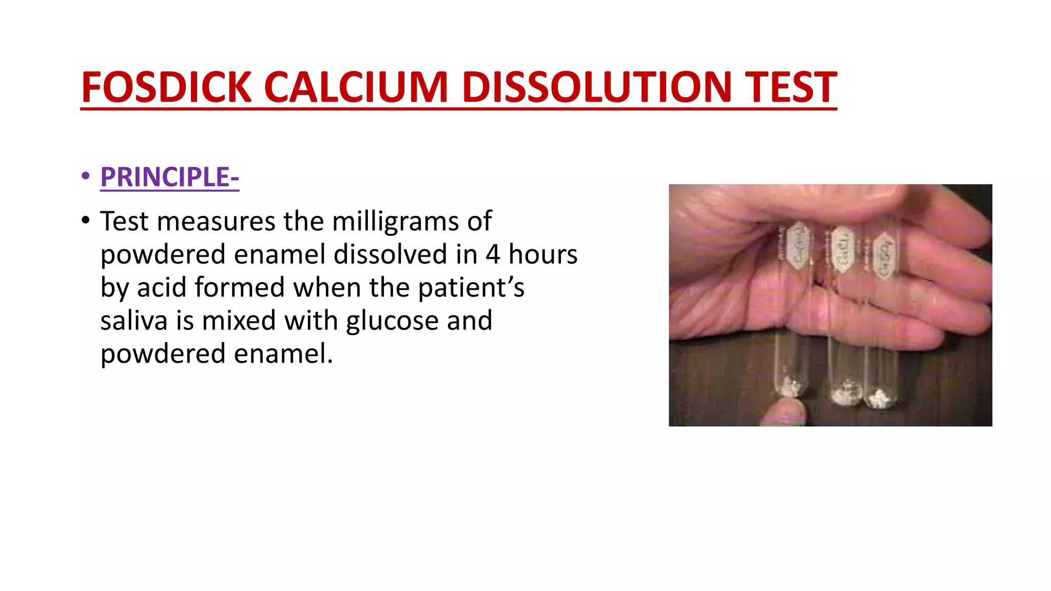 Caries activity test | PPTX