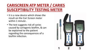 Caries activity test | PPTX