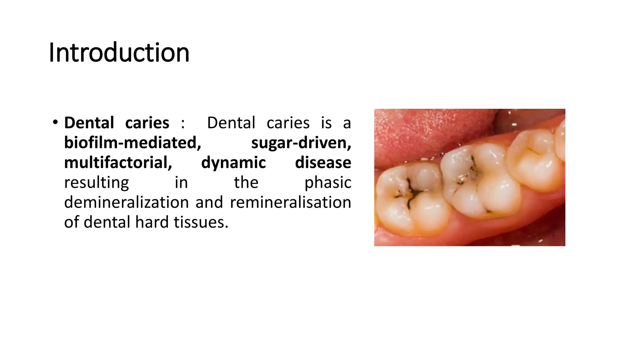 CARIES ACTIVITY TESTS caries vaccime.pptx