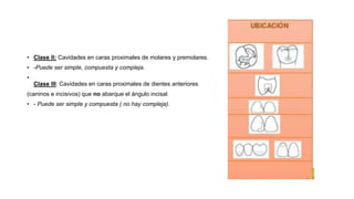 Caries bucal | PPTX
