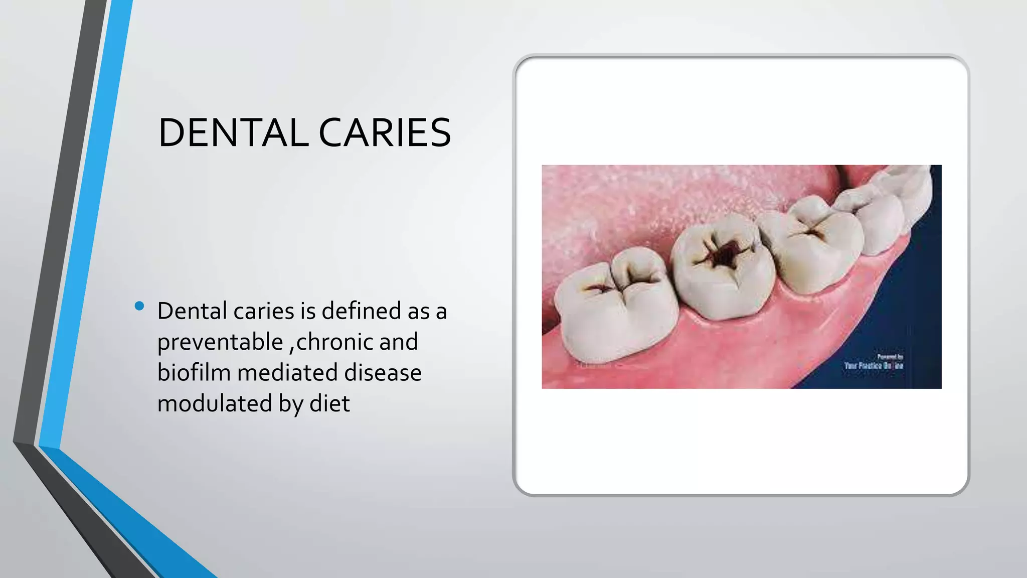 Caries Classification.pptx