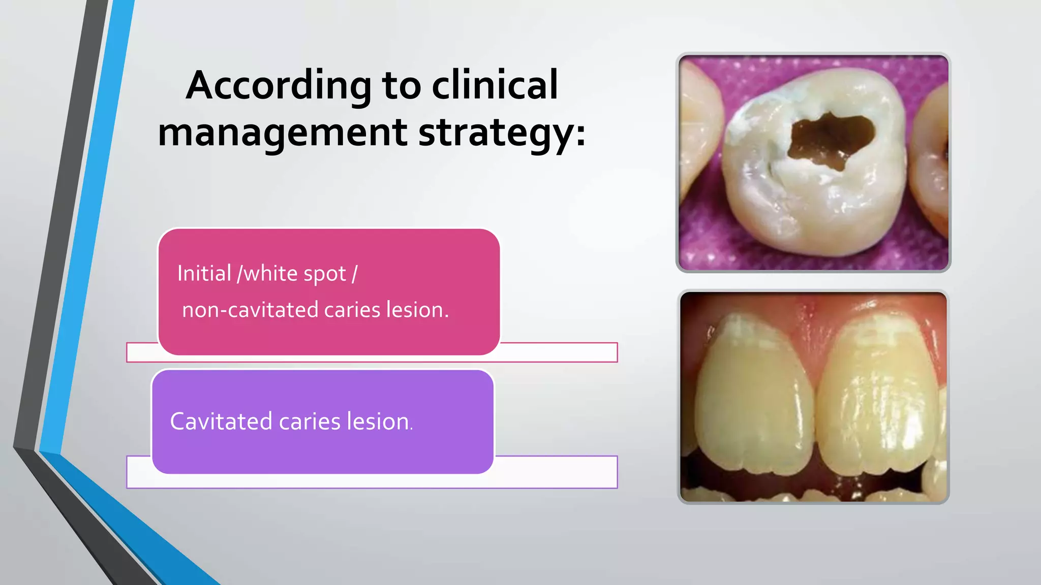 Caries Classification Pptx