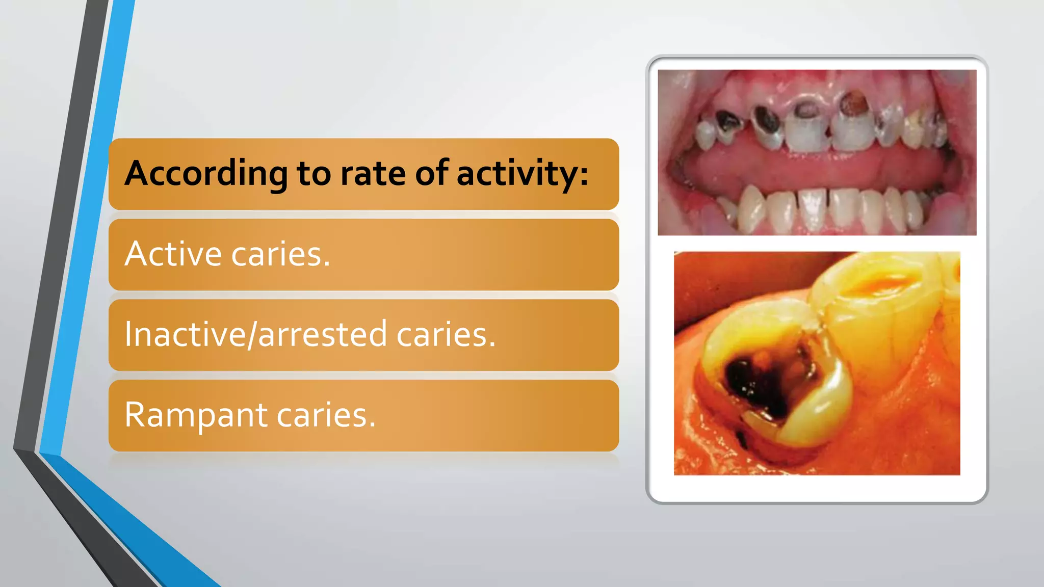 Caries Classification.pptx