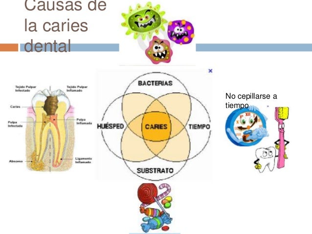 Caries dental