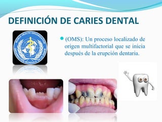 Caries dental | PPT