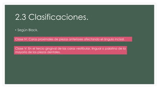 Caries Dental | PPTX