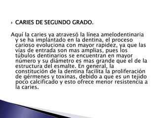 Caries dental | PPTX