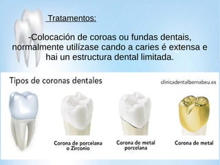 Caries dental | ODP