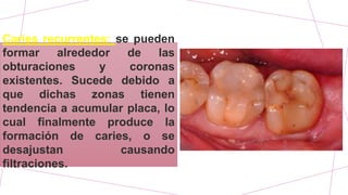 CARIES- TIPOS DE CARIES- TRATAMIENTOS | PPTX