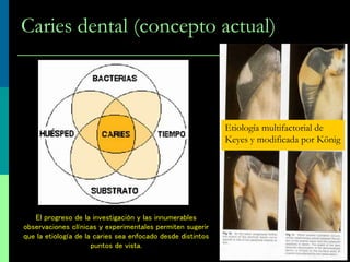 Caries Dental Consideraciones históricas.ppt