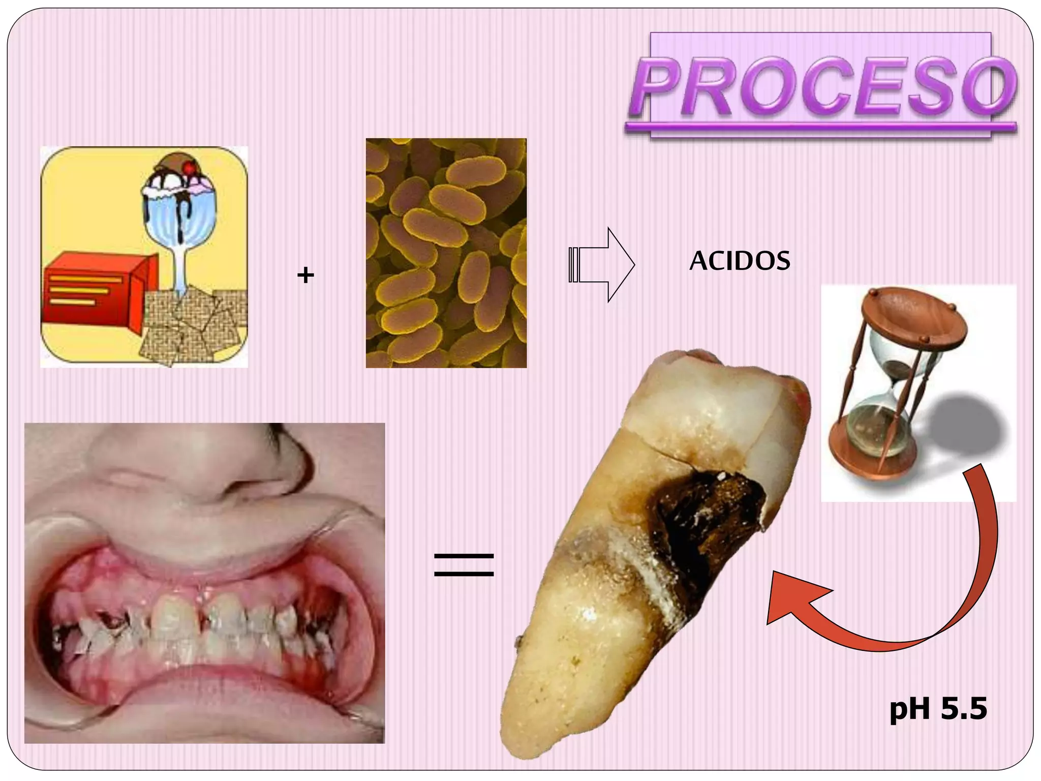 Caries Dental Pediátrica - Odontopediatría | PPT