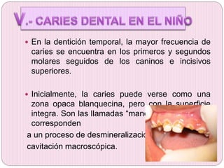 Caries Dental Pediátrica - Odontopediatría | PPT