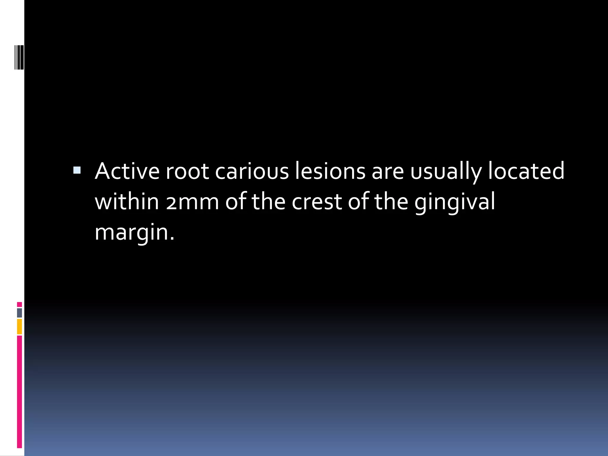 Caries diagnosis | PPTX
